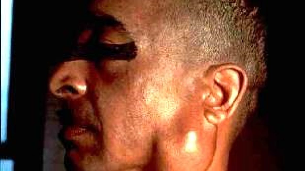 Lump On Neck Behind Ear